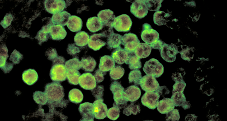 Silver nanoparticles help fight brain-eating amoebas