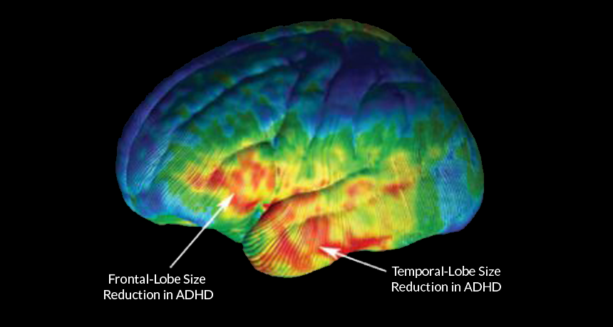 Brain signals attention disorder