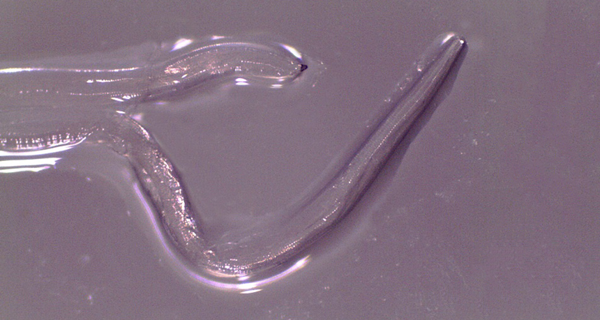 Woman’s eye hosts more than a dozen cattle eyeworms