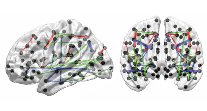 Mapping the brain’s highways