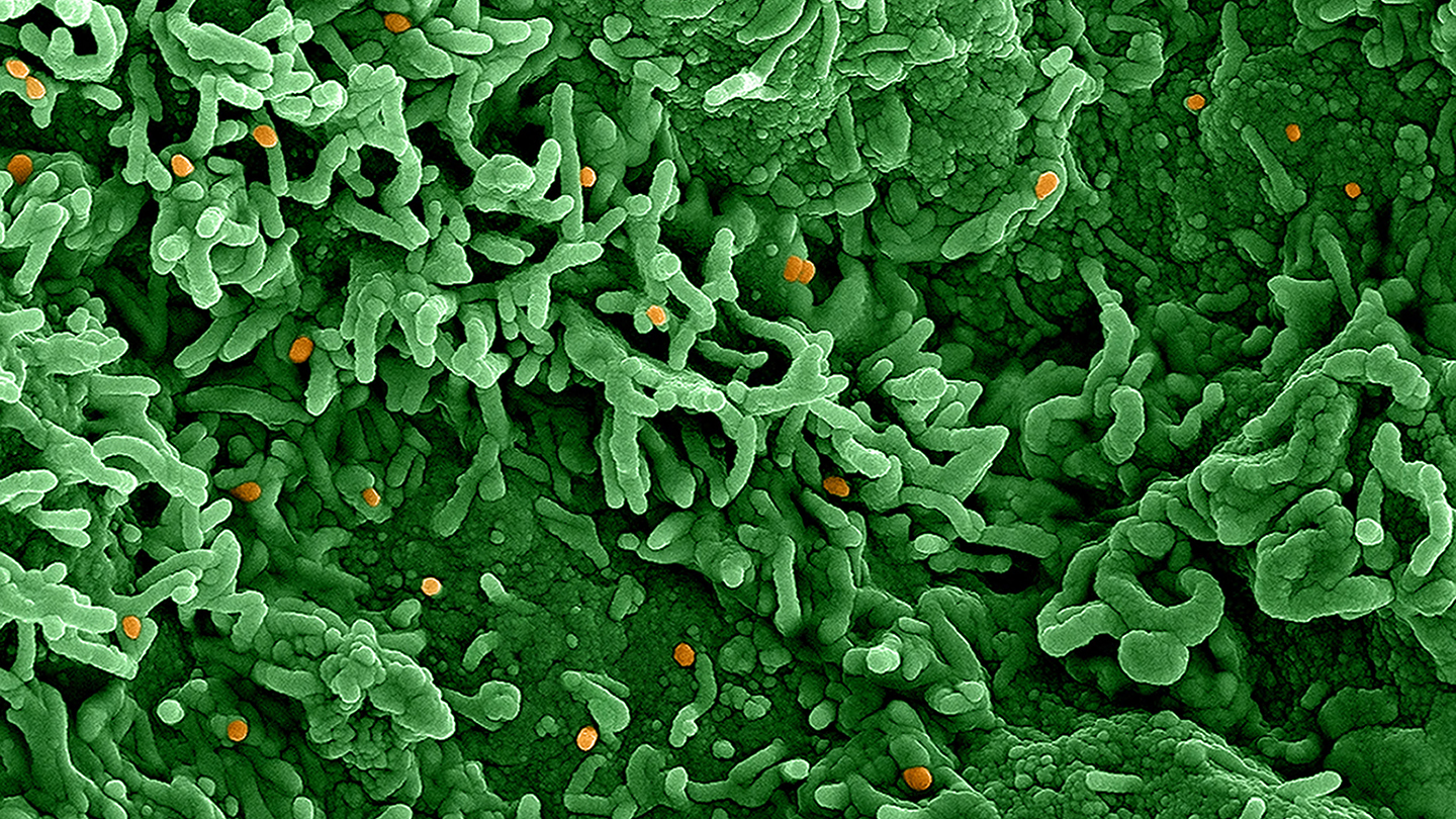 Janet Raloff, Author at Science News Explores