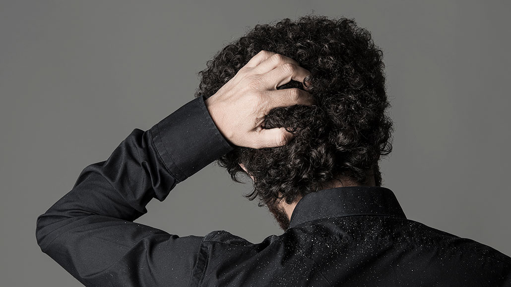 Why dandruff shouldn't get a brush-off