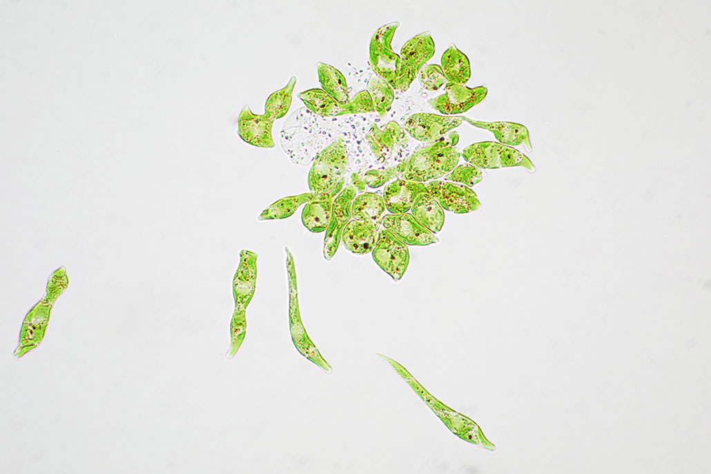 Under the microscope, this biologist sees the complex world of protists