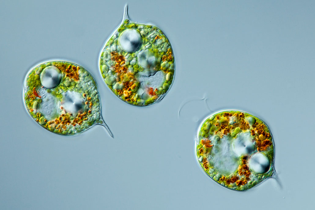 Under the microscope, this biologist sees the complex world of protists