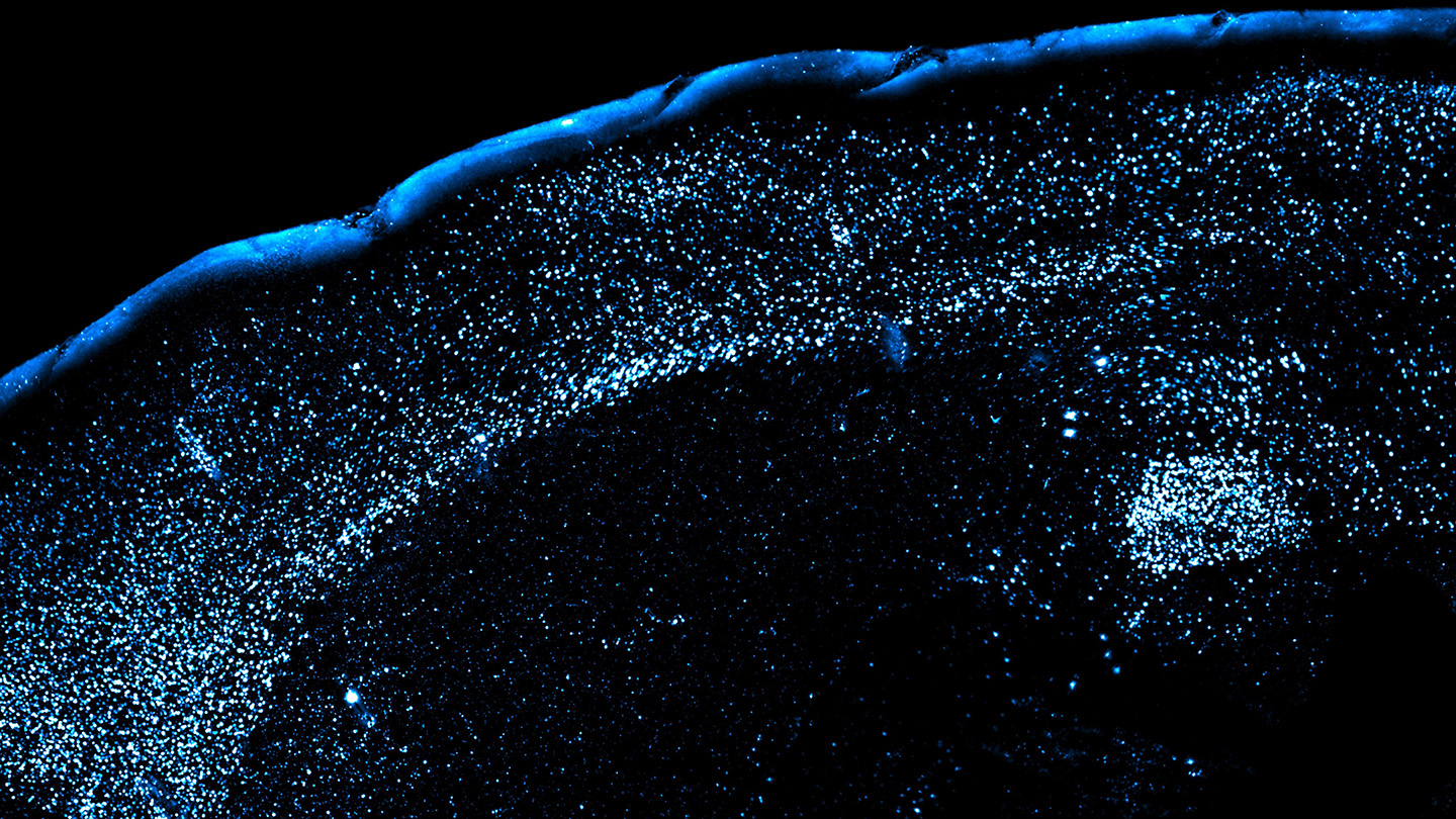 Could the magic of memory manipulation ever become real?