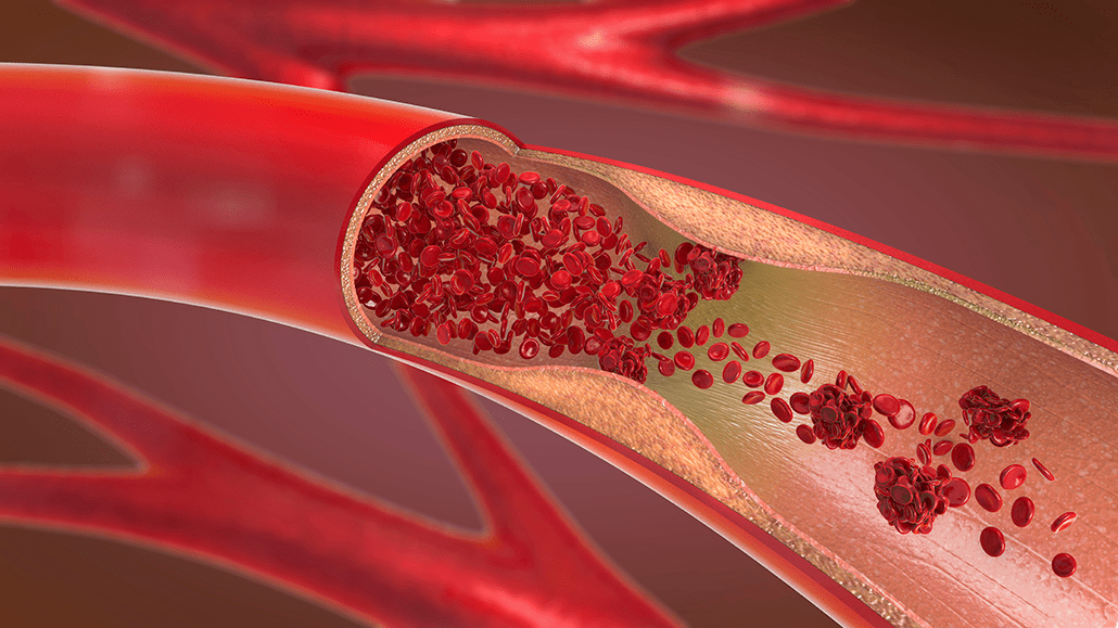 Here’s why your blood vessels don’t burst under pressure