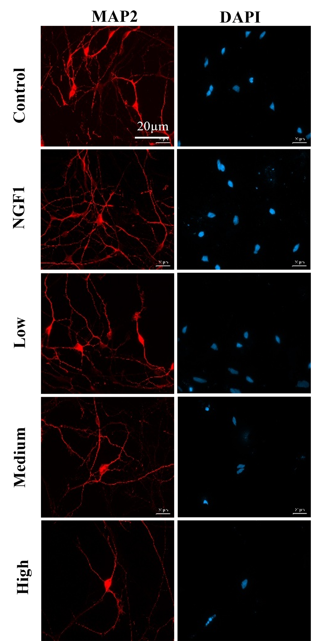 Caffeine may dial down genes crucial for brain development, teen finds